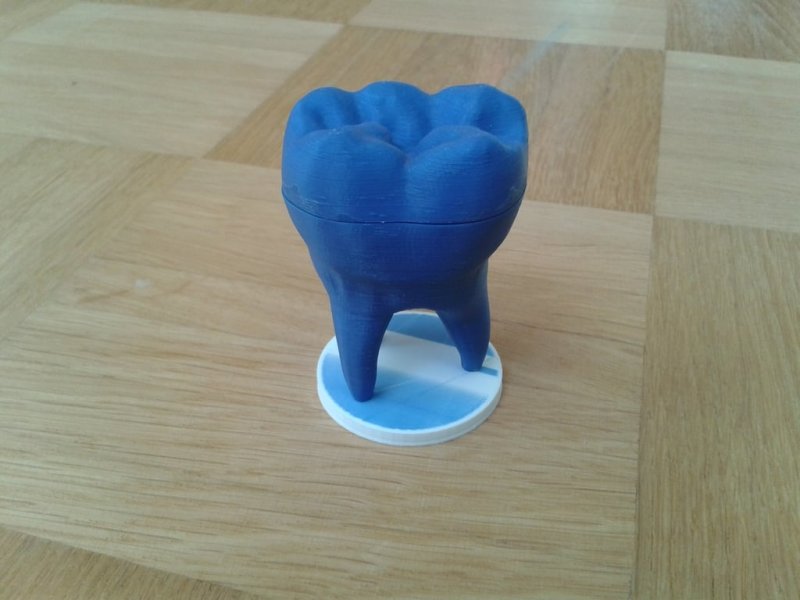 Baby Tooth Box 3D Printer Model Download Free STL File - 3axis.co